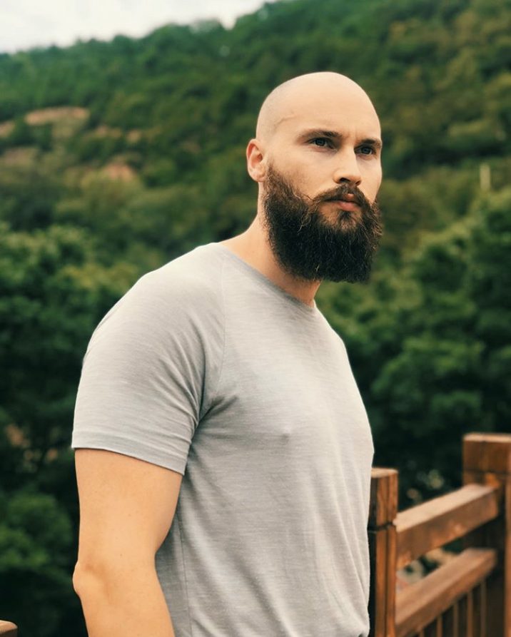 Bald and beautiful – Sheridan Sun